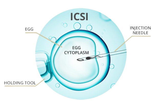 Understanding ART: Types of Assisted Reproductive Technologies